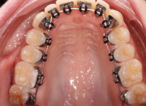 Techniques de pointe - Orthodontiste Bordeaux